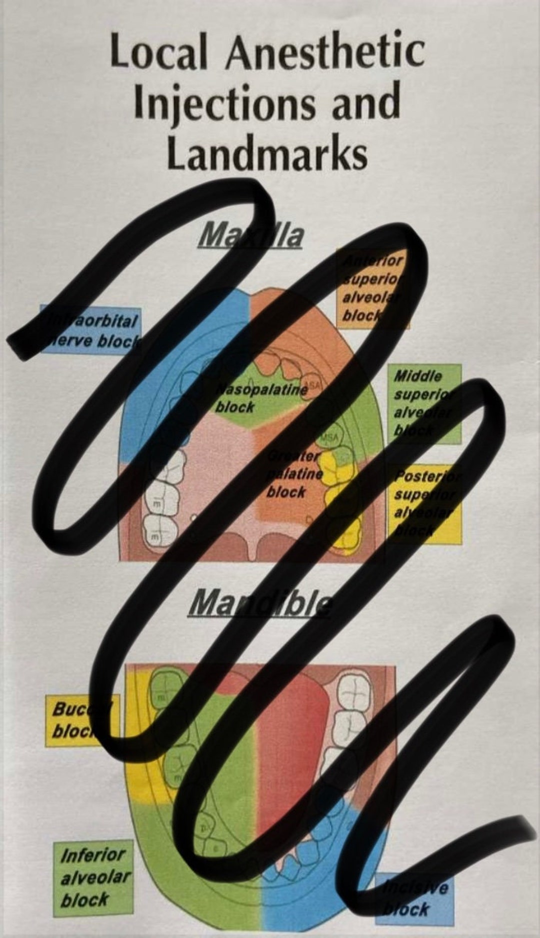 Local Anesthetic Reference Book - Etsy