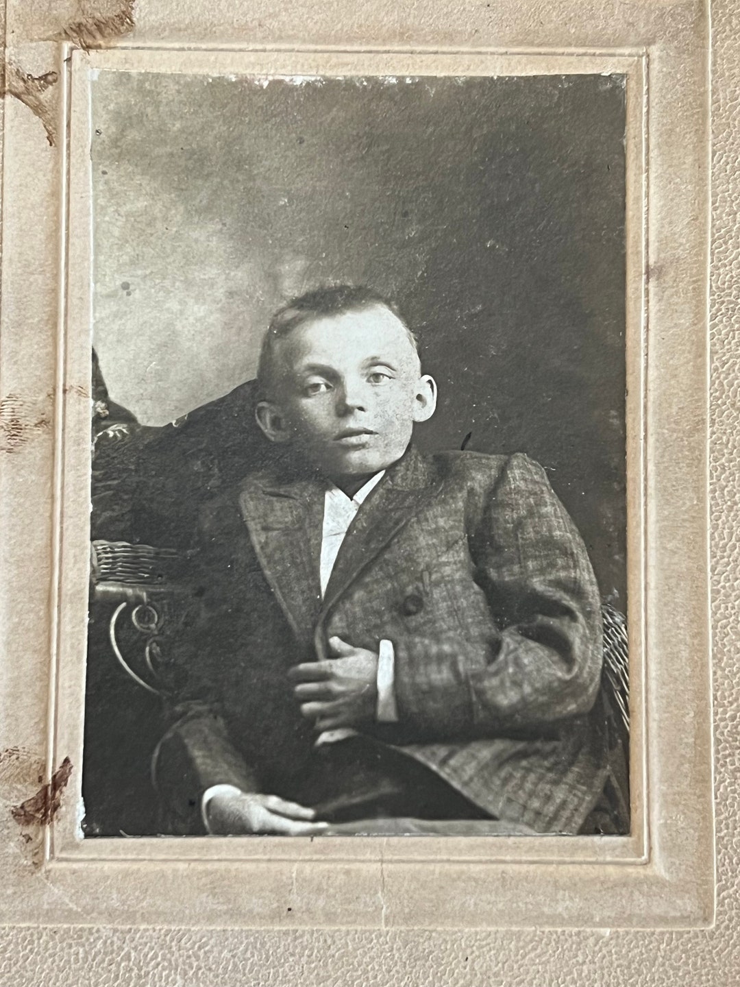 Medical Deformity Child Post Mortem Haunted Vintage/ Antique Original ...