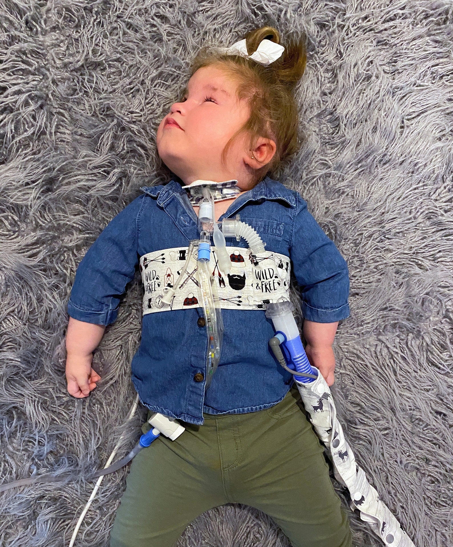 Insulated Ventilator CPAP Bipap Circuit Cover/wrap Prevents ...