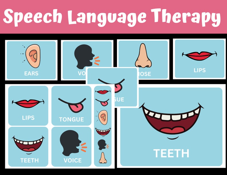 Speech Posters | Speech Language Therapy | SLP | Strategies | Bookmark ...