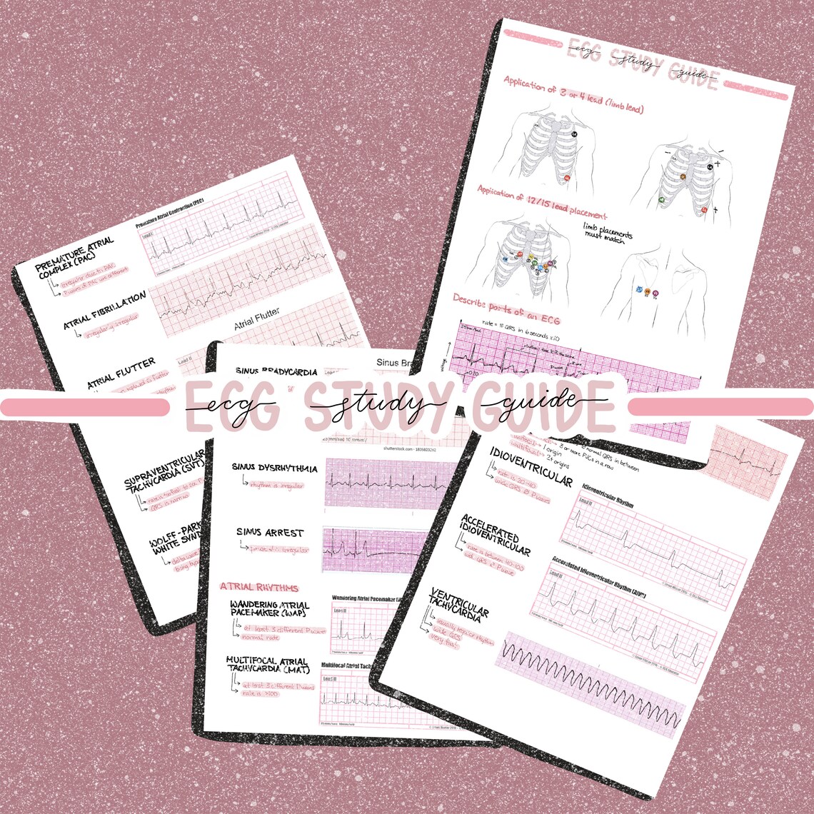 ECG Study Guide - Etsy