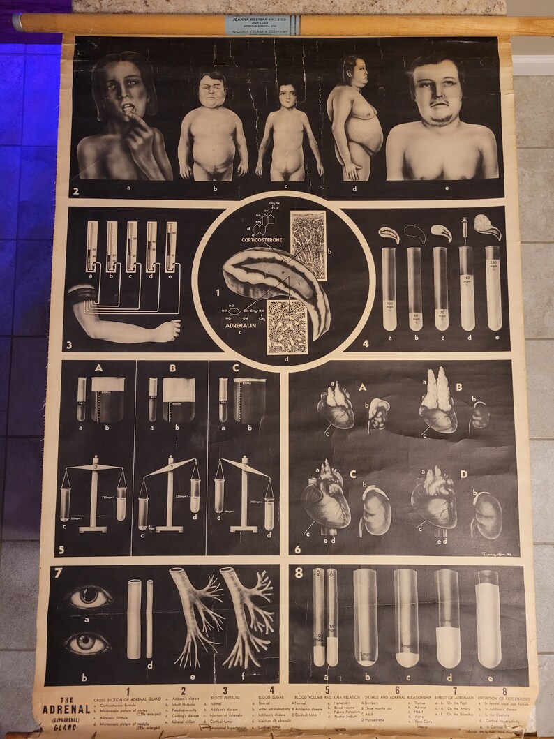 Anatomy Posters on Canvas - Etsy