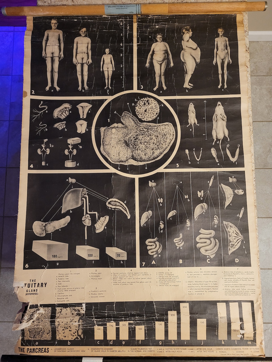 Anatomy Posters on Canvas | Etsy