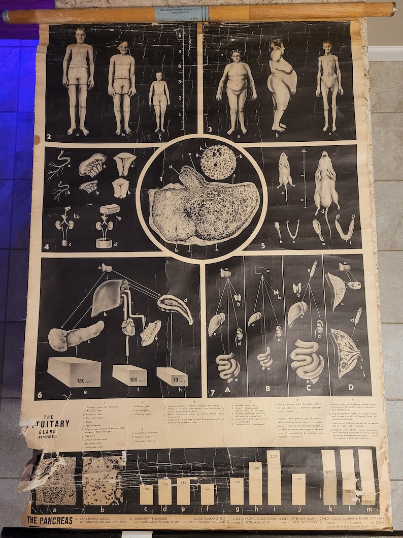Anatomy Posters on Canvas - Etsy
