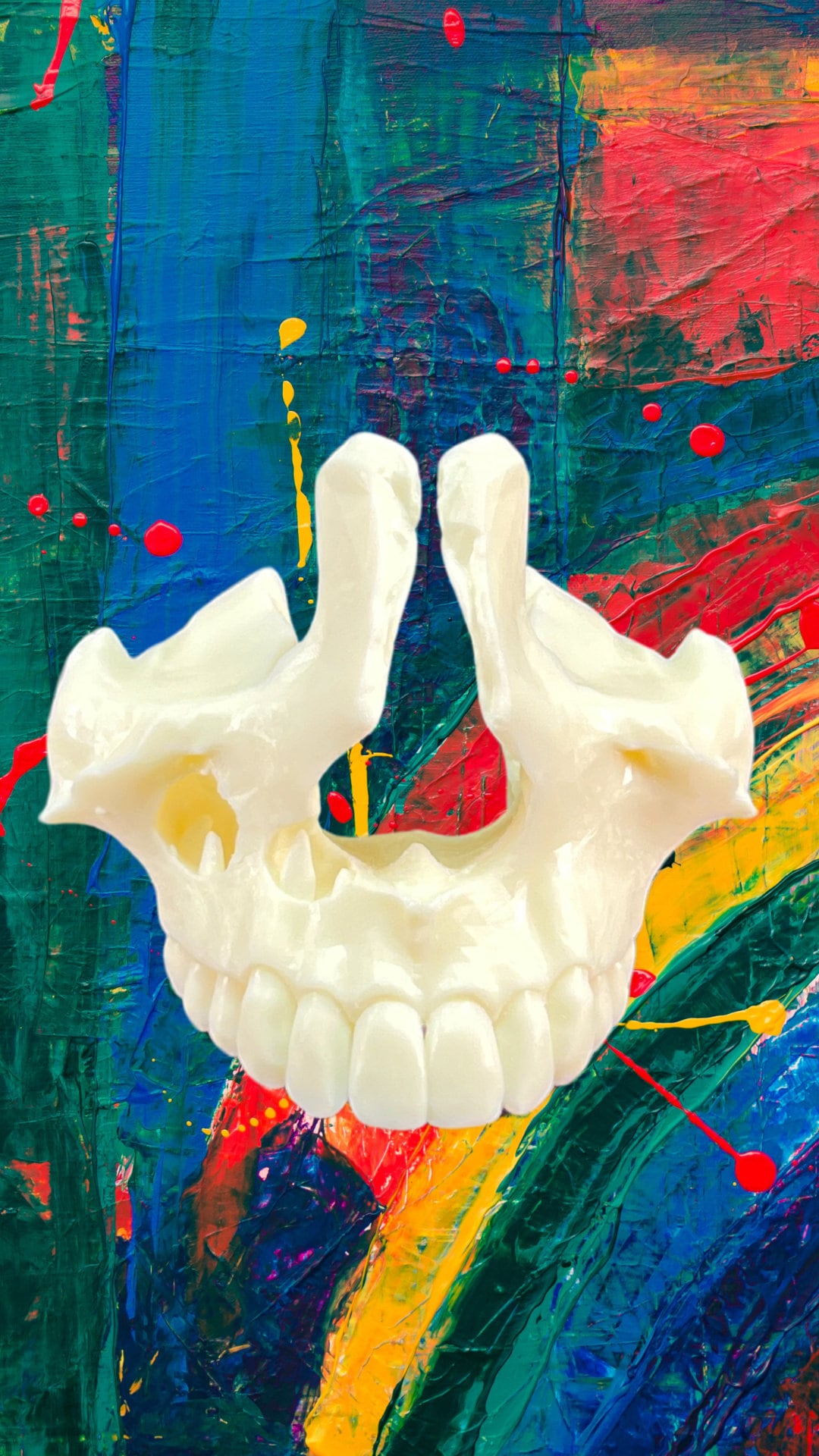 Maxillary Dental Model: Normal Vs. Cystic Pathology Educational Visual ...