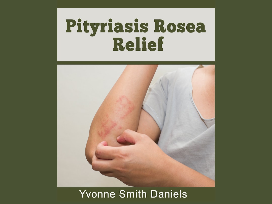 Pityriasis Rosea Relief Ebook, Itchy Dry Skin Rash Relief Ebook Pdf ...