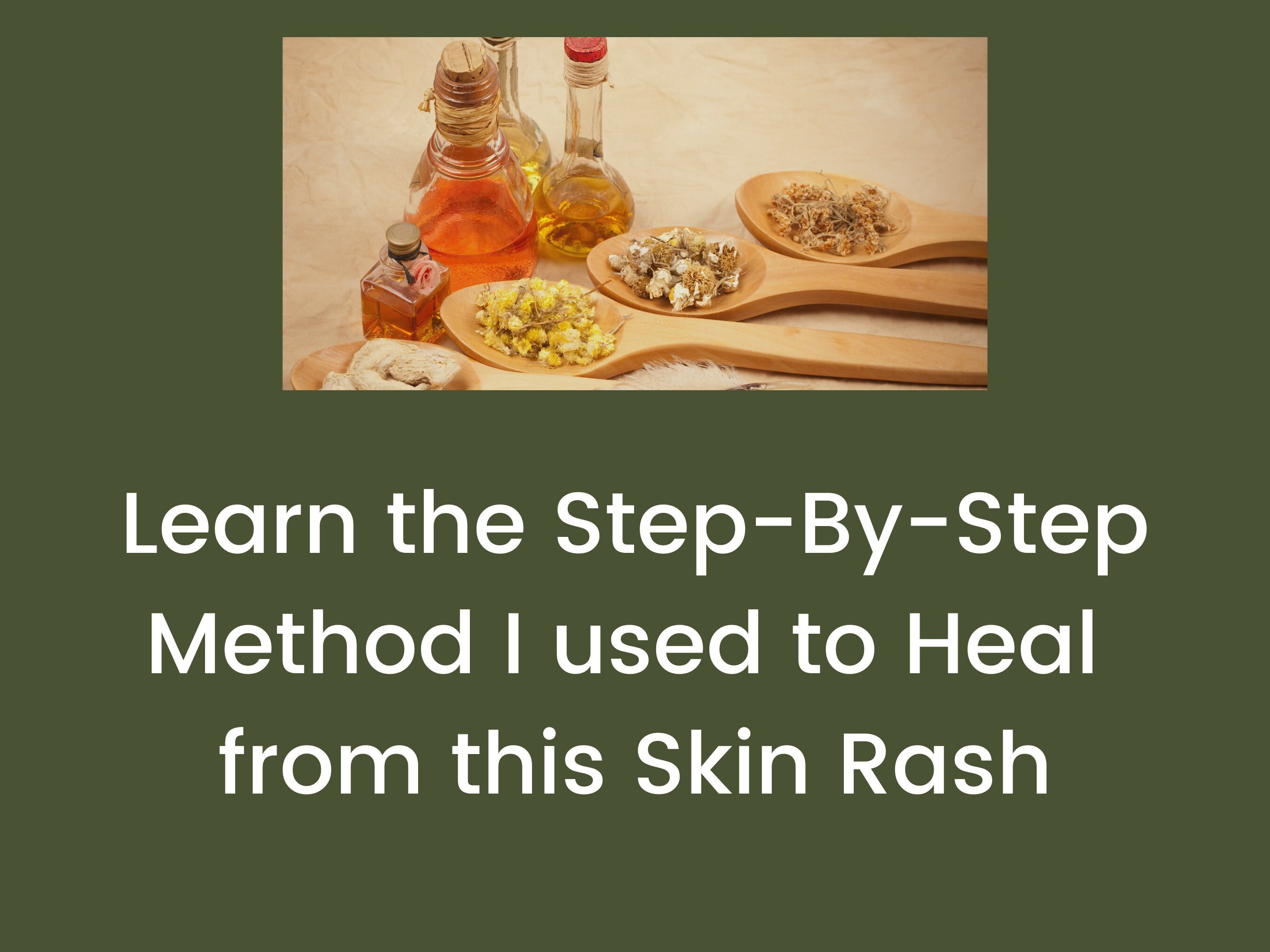 Pityriasis Rosea Relief Ebook Itchy Dry Skin Rash Relief Ebook Pdf Wellness Remedies Ebook