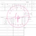 Cesarean Section Report Sheet | Circulating OB Nurse | OB Nurse | Lnd ...