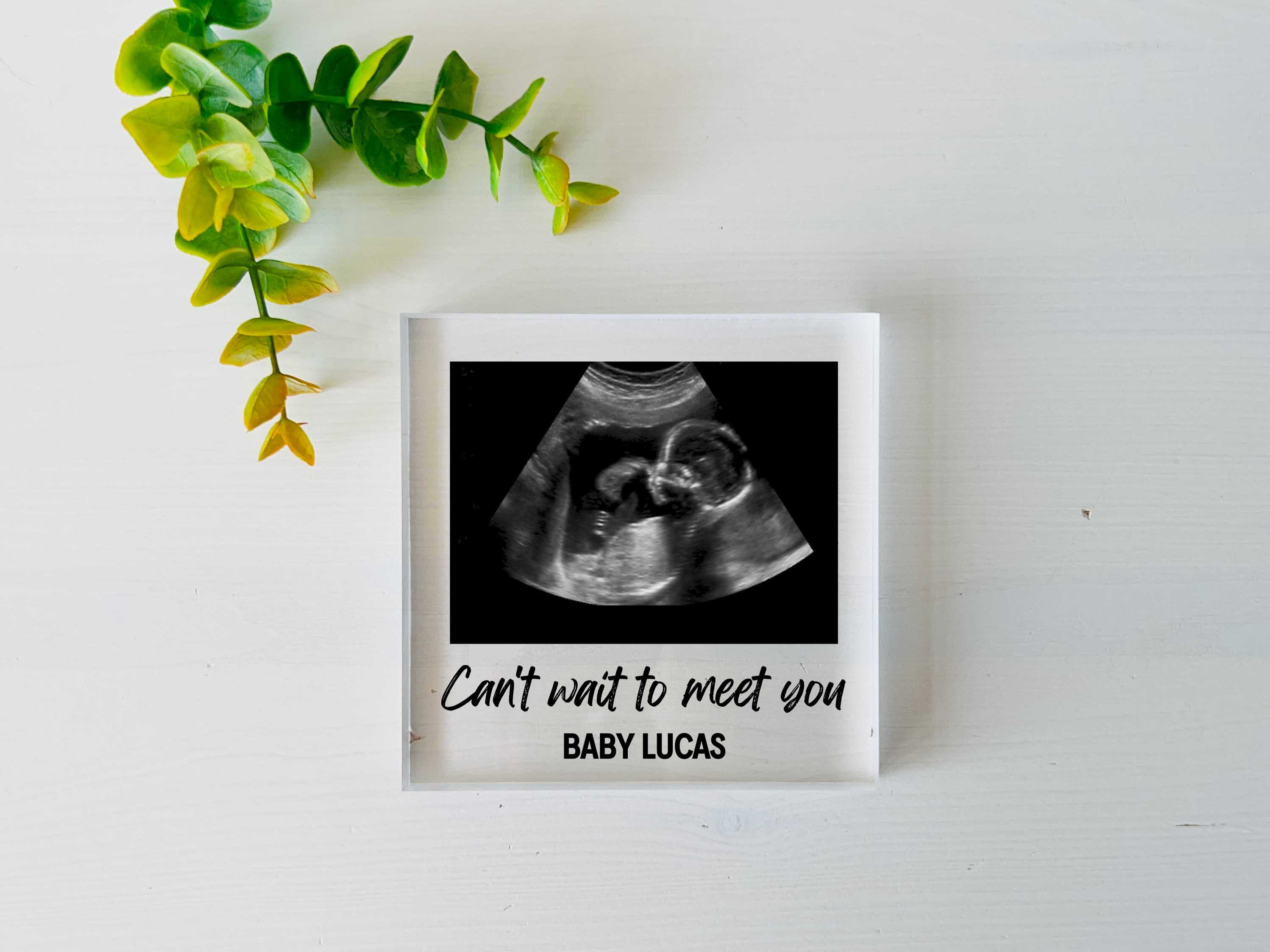 Custom Baby Scan Photo - New Baby Scan Gift, Pregnancy Announcement ...