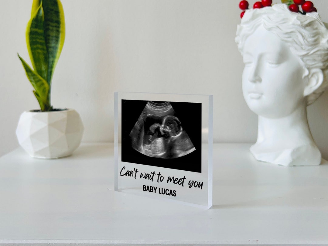 Custom Baby Scan Photo - New Baby Scan Gift, Pregnancy Announcement ...