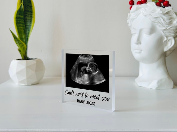 Custom Baby Scan Photo New Baby Scan Gift Pregnancy - Etsy