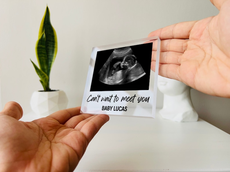 Custom Baby Scan Photo New Baby Scan Gift Pregnancy - Etsy