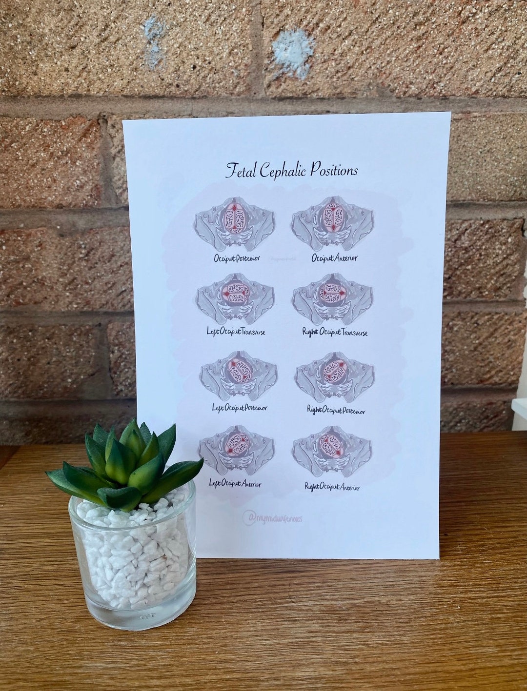 Fetal Cephalic Positions Poster - A5 or Digital - Etsy