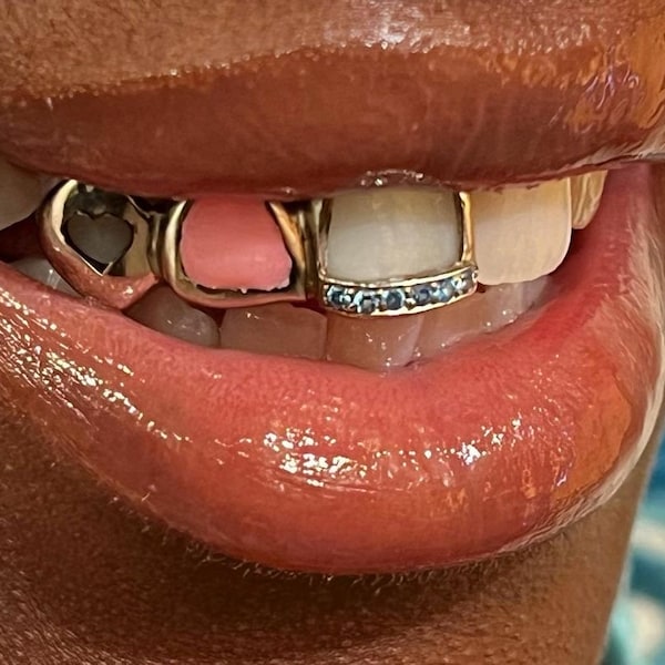 Gold Window Tooth - Etsy