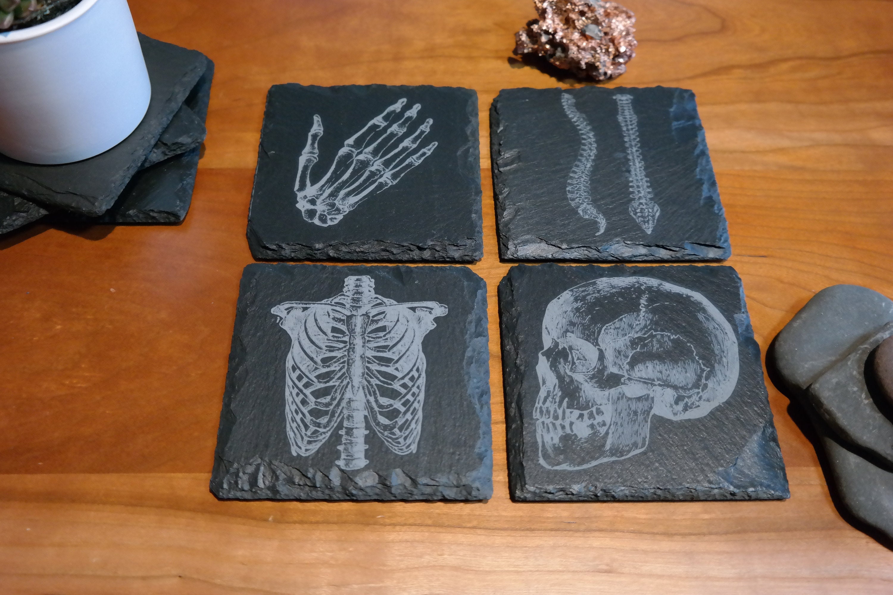 Engraved Slate Coasters Set of 4 Anatomy Skeleton Bones - Etsy