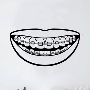 Braces Smile Wall Decal Art Sticker Vinyl Home Decor Girls Boys Dentist ...