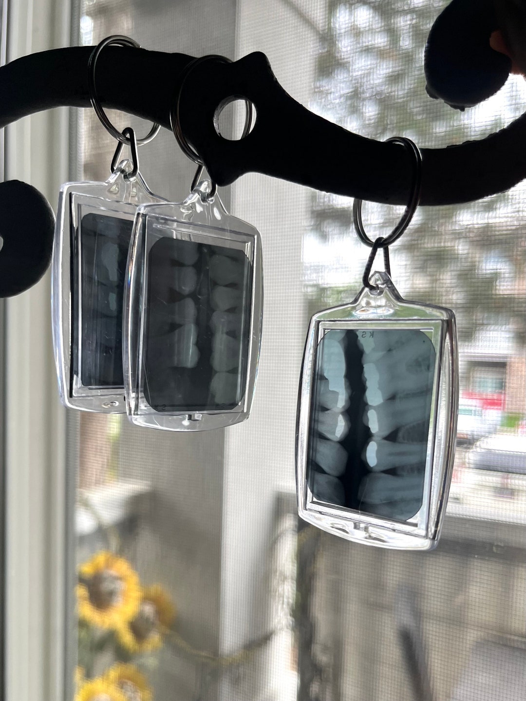 Dental X-ray Keychain | Junk Drawer | Oddities | Curiosities | Dentist ...