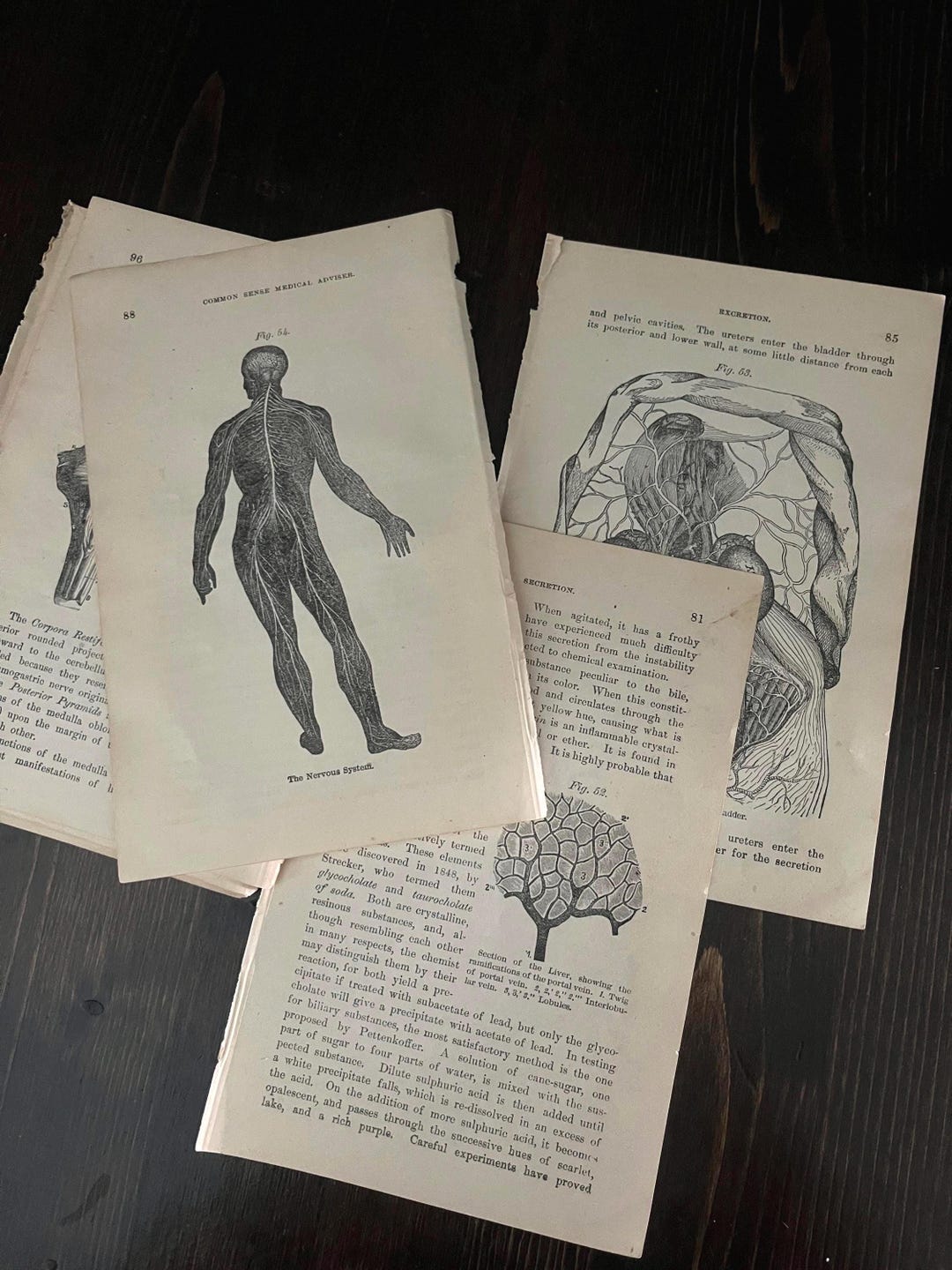 Vintage Anatomy Book Pages • Set of 10 | Illustrated | Pathology ...