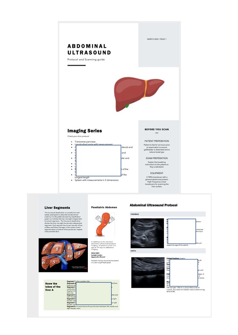 Abdominal Ultrasound Protocol and Scanning Guide - Etsy