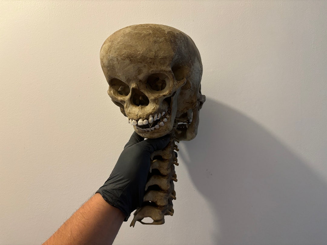 Edward Mordrake Skull Replica / Oddities / Cabinet of Curiosities - Etsy