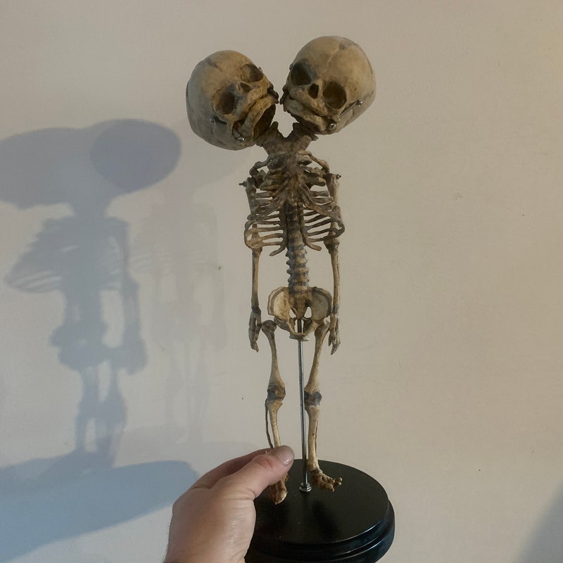 Two Headed Skeleton - Etsy