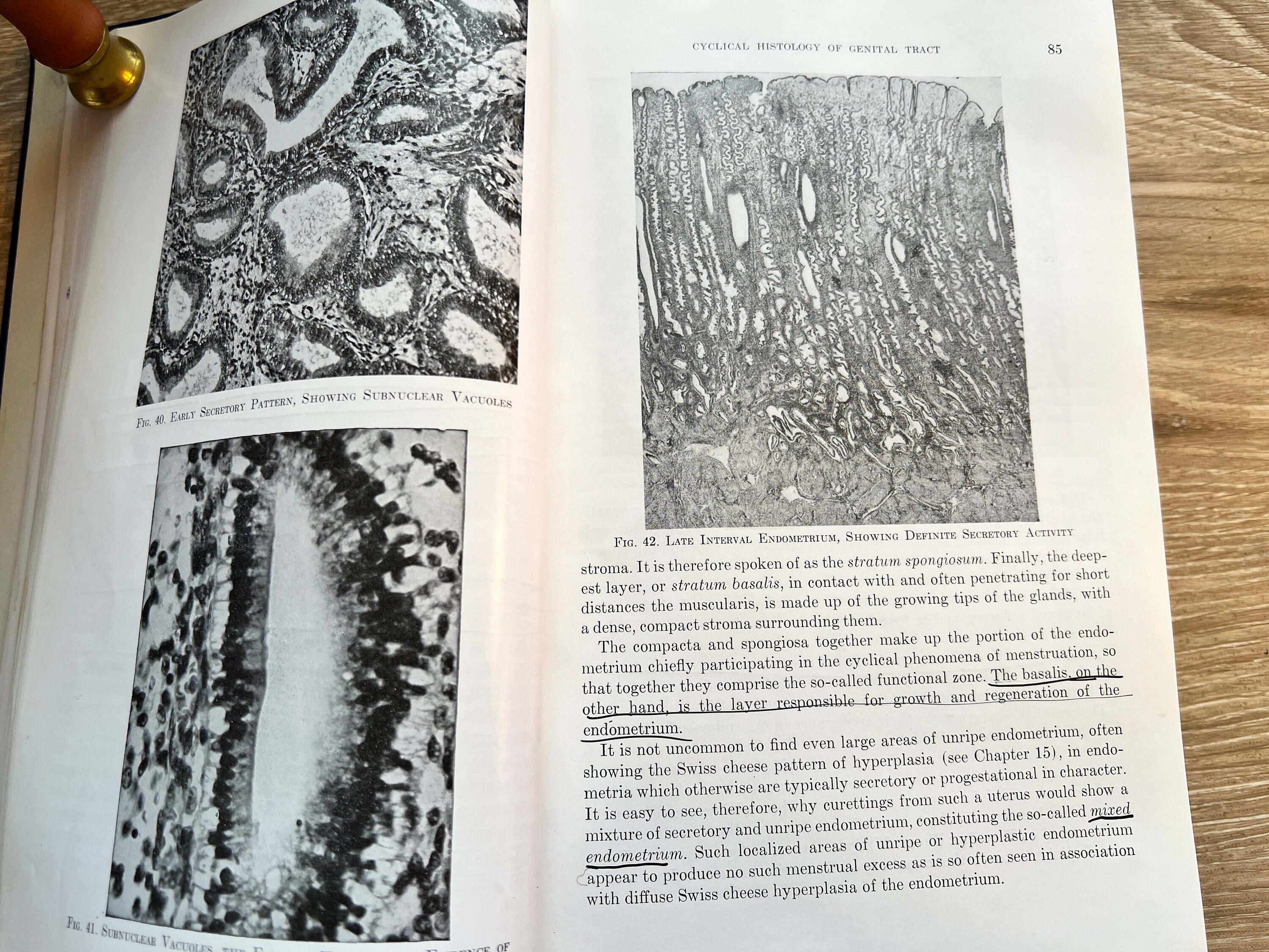 Novak's Textbook of Gynecology, 6th Edition 1961, by Edmund Novak and ...