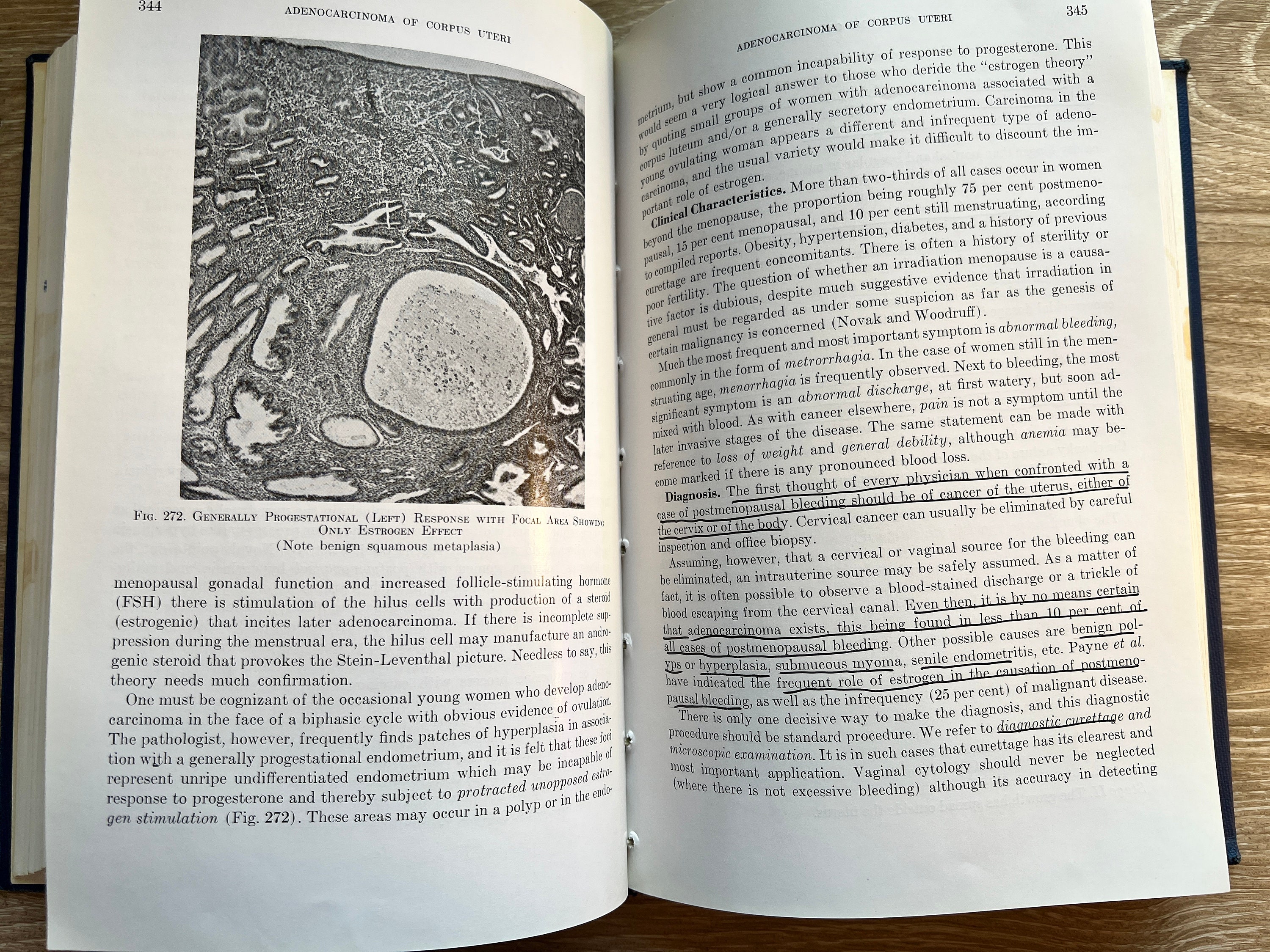 Novak's Textbook of Gynecology, 6th Edition 1961, by Edmund Novak and ...