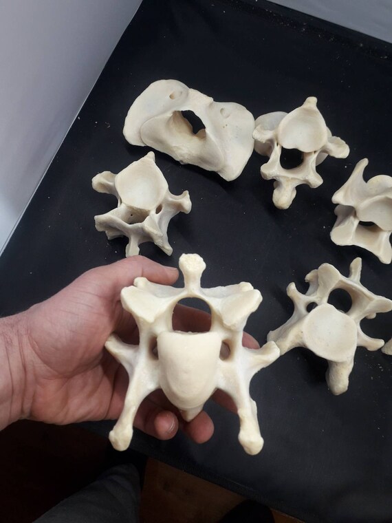 Cow Cervical Vertebrae