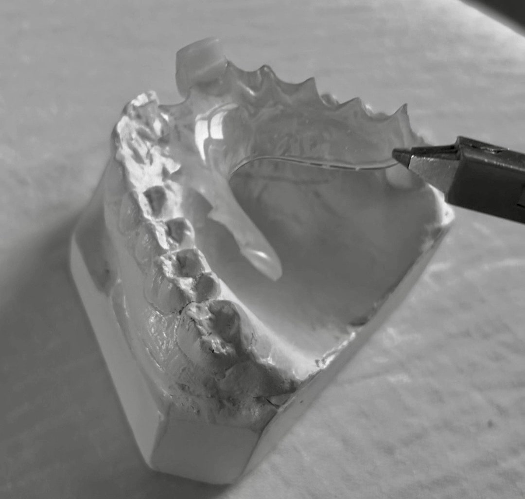 Flipper Nesbit Custom Fitted Missing Teeth Space Filler Cosmetic ...