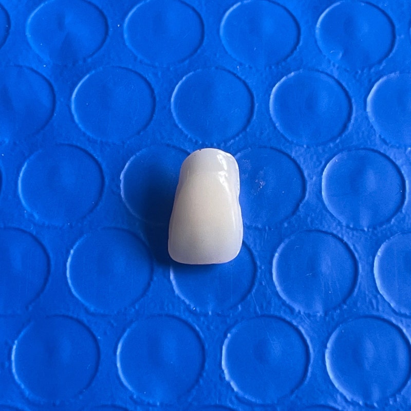 Flipper Tooth - Etsy