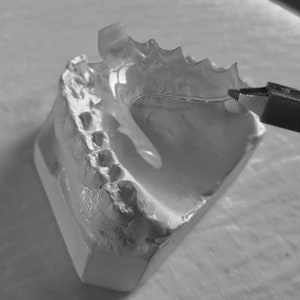 Flipper Nesbit Impression Kit Missing Tooth Space Filler Cosmetic ...