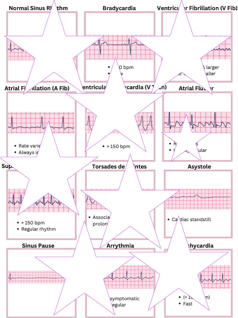 Lab Values, Electrolytes, EKG Cheat Sheet | Digital PDF | 3 Pages ...