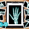 Printable Animal X-rays for Kids. Pretend Play Kids X-ray Activity for ...