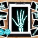 Printable X-rays for Kids. Pretend Play Kids X-ray Activity for Playing ...