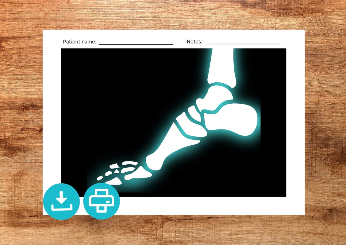 Printable X-rays for Kids. Pretend Play Kids X-ray Activity - Etsy