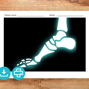 Printable X-rays for Kids. Pretend Play Kids X-ray Activity for Playing ...