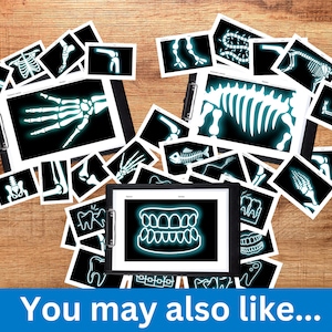 Printable Dental X-rays for Kids. Pretend Play Kids X-ray Activity for ...