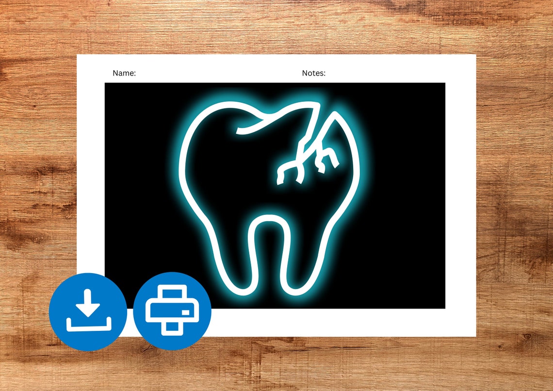 Printable Dental X-rays for Kids. Pretend Play Kids X-ray Activity for ...