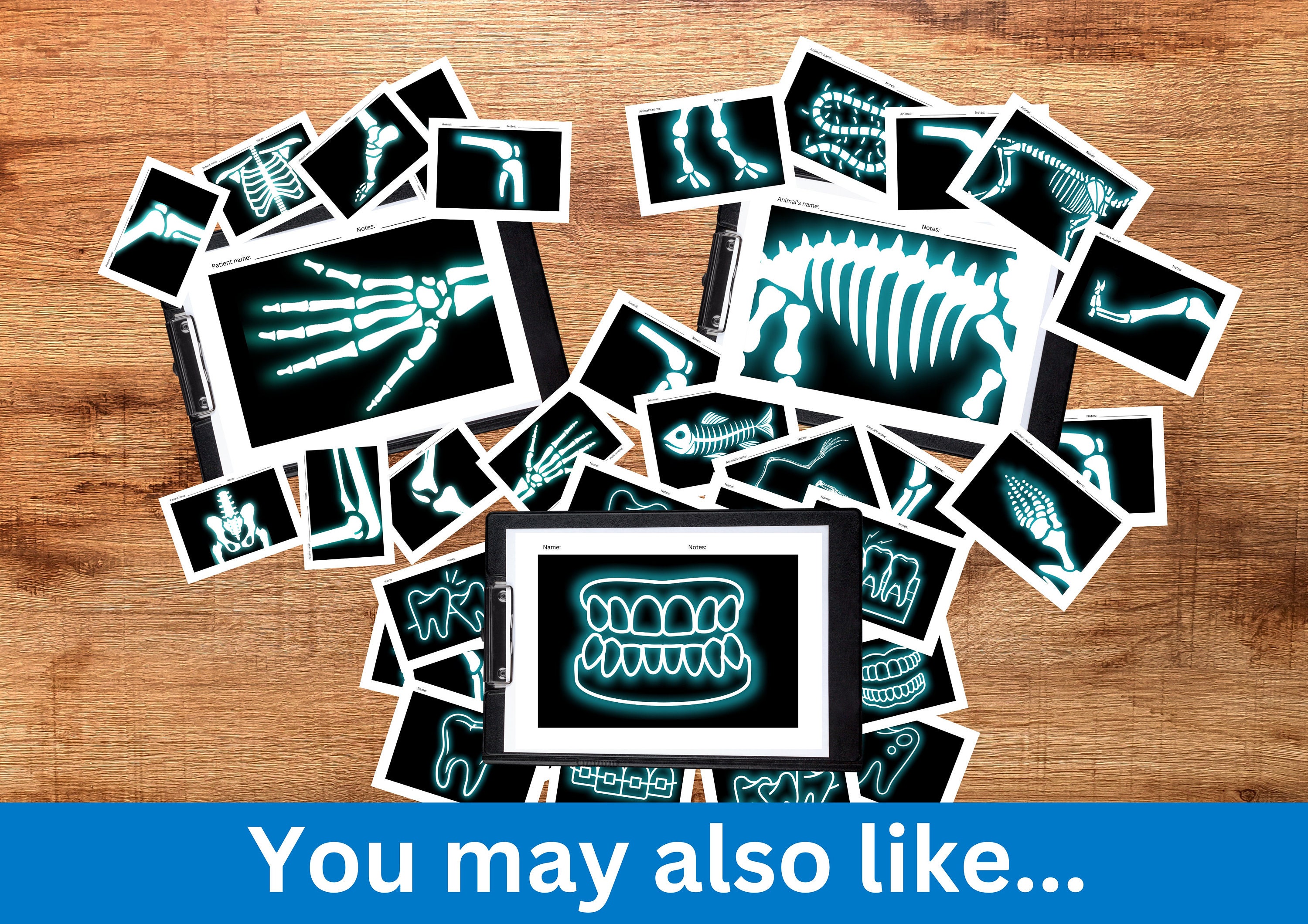 Printable X-rays for Kids. Pretend Play Kids X-ray Activity for Playing ...