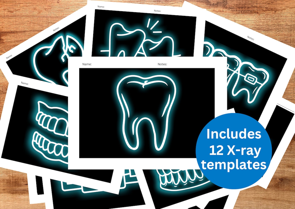Printable Dental X-rays for Kids. Pretend Play Kids X-ray Activity for Dentist Role Play. Print ...