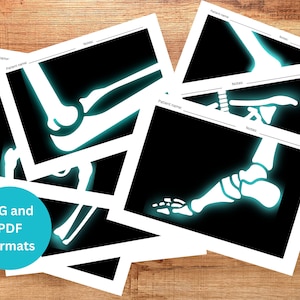 Printable X-rays for Kids. Pretend Play Kids X-ray Activity for Playing ...