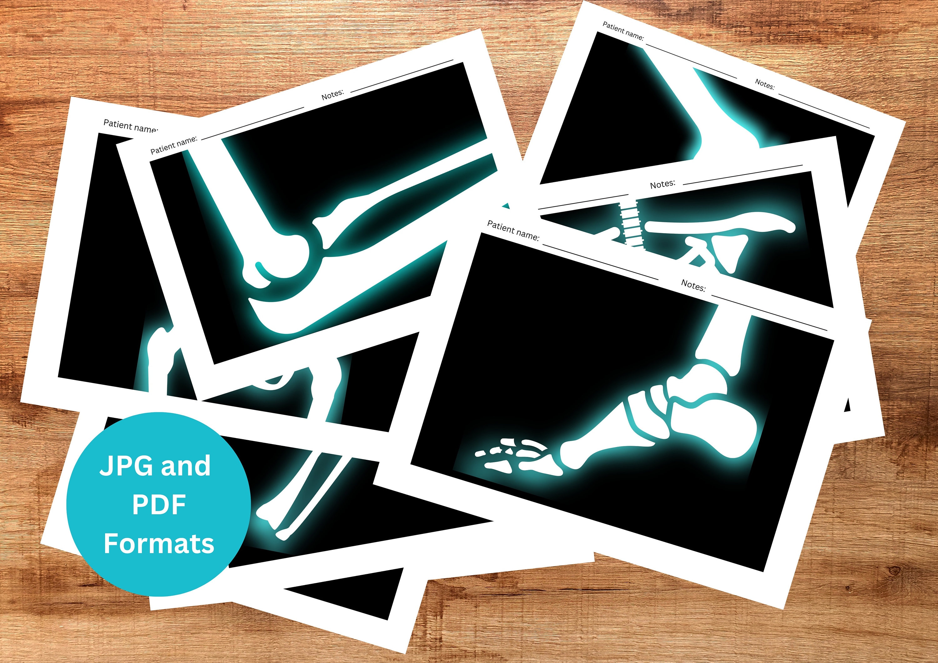 Printable X-rays for Kids. Pretend Play Kids X-ray Activity for Playing ...