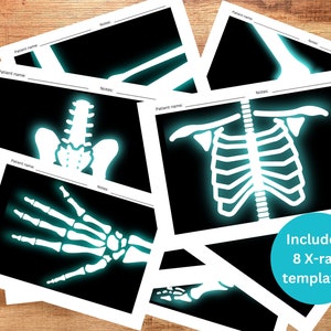Printable X-rays for Kids. Pretend Play Kids X-ray Activity for Playing ...