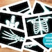 Printable X-rays for Kids. Pretend Play Kids X-ray Activity for Playing ...