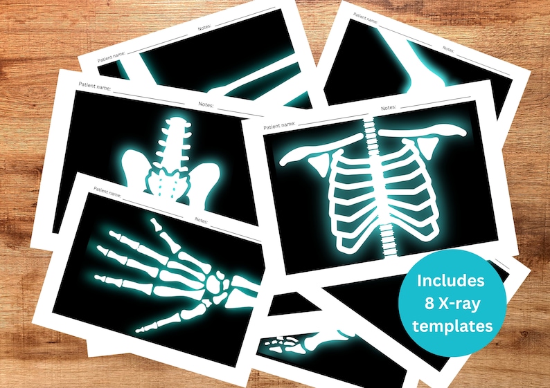 Printable X-rays for Kids. Pretend Play Kids X-ray Activity for Playing ...