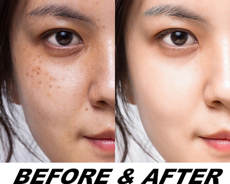 Photo Editing, Face Retouch, Natural Skin Retouching, Portrait Retouch ...