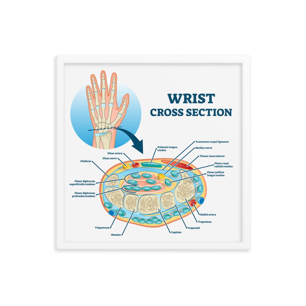 Wrist Cross Section Medical Framed Photo Paper Poster. - Etsy