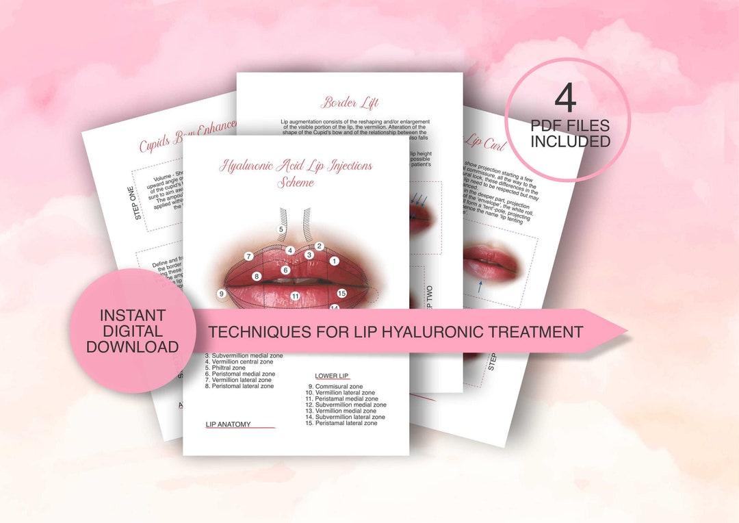 Hyaluronic Pen Lip Techniques, Russian Lips, Cupids Bow Lift, Keyhole ...