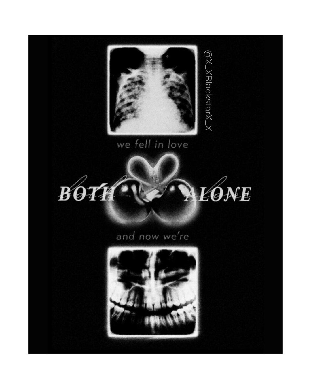 X-ray PTV Love Anatomy Poster | Matte Vertical Poster - Etsy