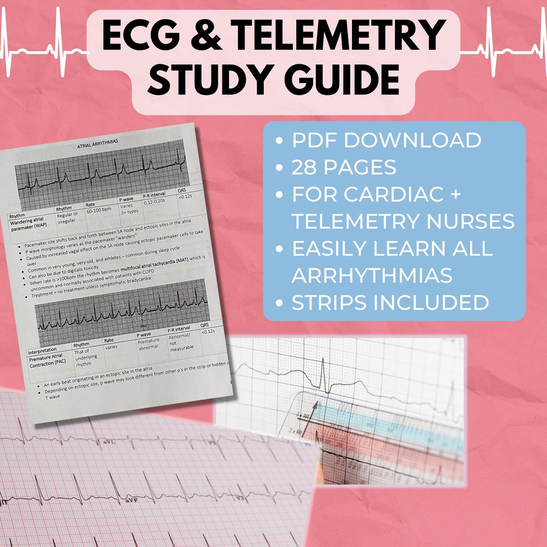 Cardiac Arrhythmia Study Guide - Etsy